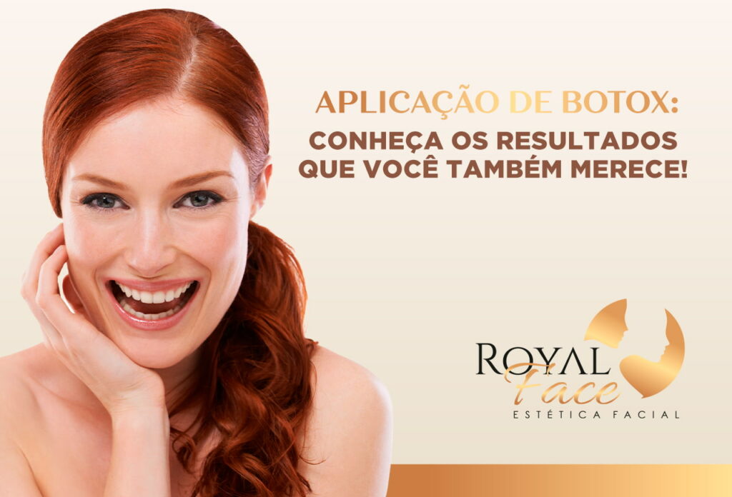 Aplicação de botox: conheça os resultados que você merece