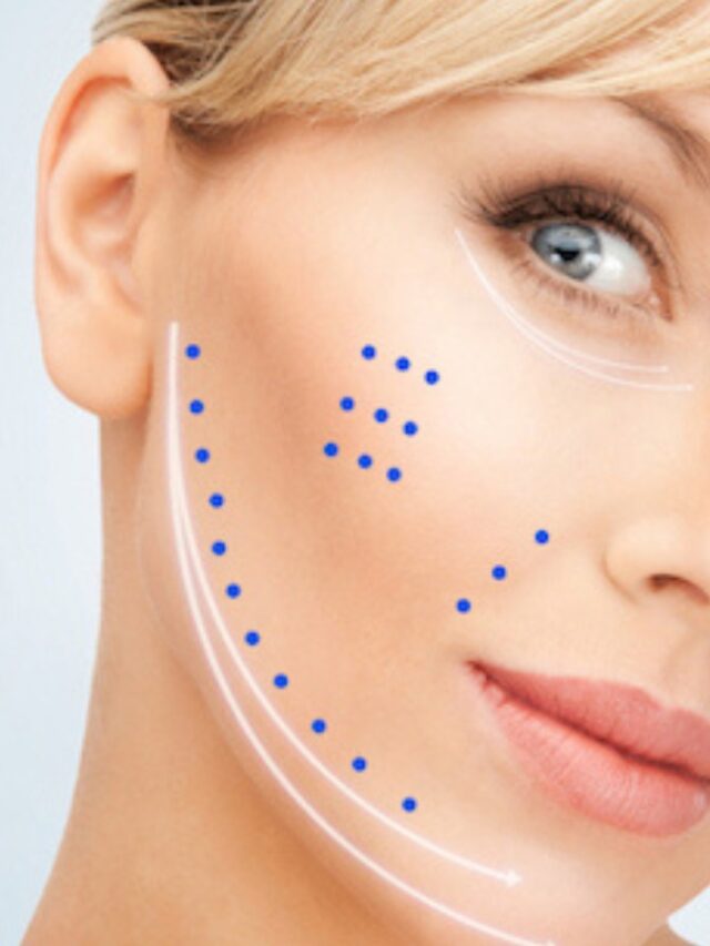 Como os bioestimuladores agem na pele? - Royal Face