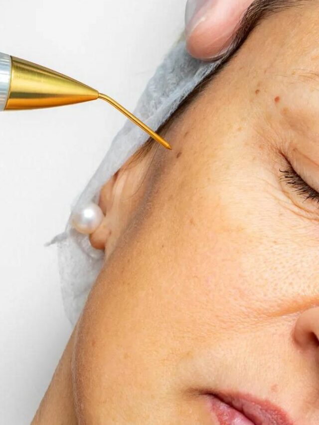 10 perguntas sobre Jet Skin - Royal Face