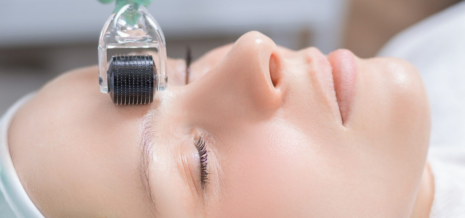 Microagulhamento - Royal Face | Clínica de Estética Facial