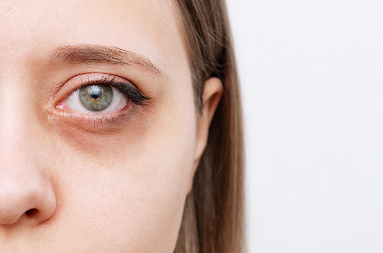Como saber se preciso de Harmonização Facial?