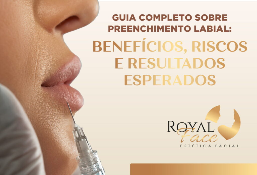 Sobre preenchimento labial: O guia completo para você!