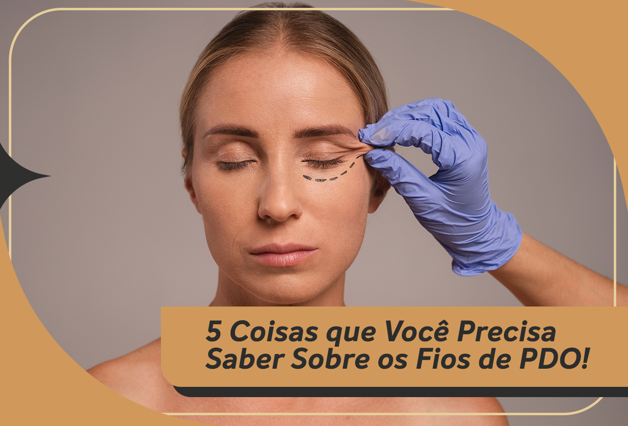 5 coisas que vc precisa saber sobre os fios de PDO!