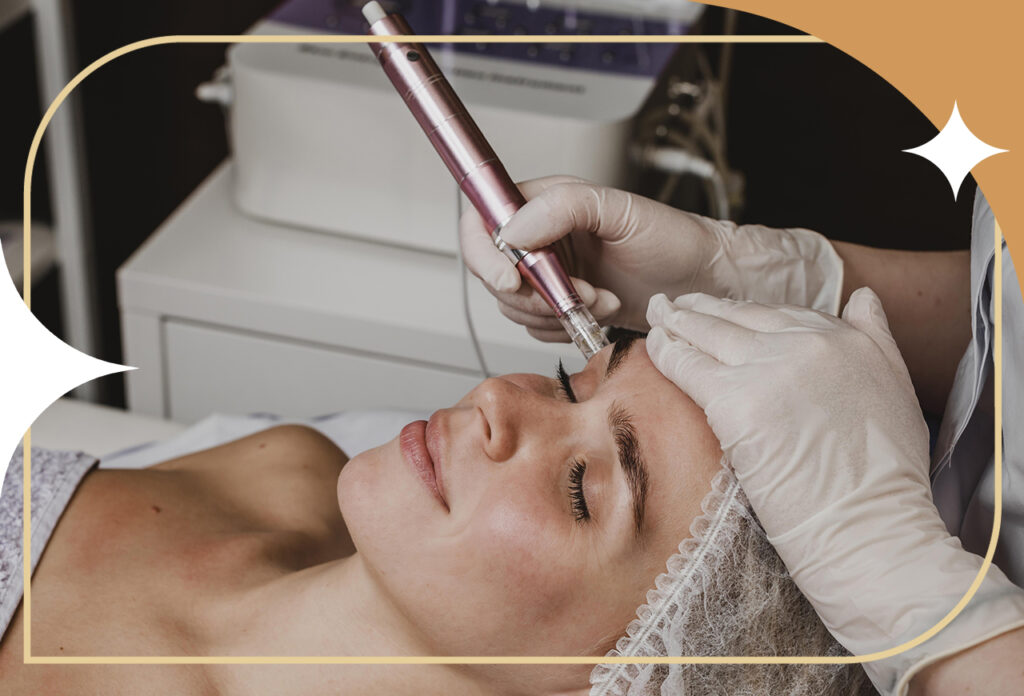 Quem pode fazer microagulhamento? Veja se é indicado pra você - Royal Face